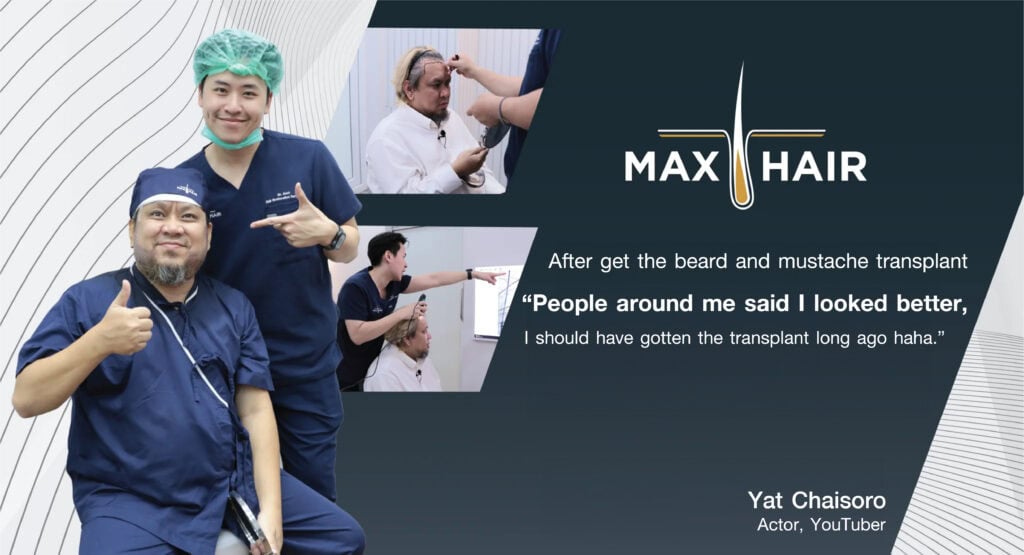 Yat Chaisoro (Actor, YouTuber) | MAX HAIR