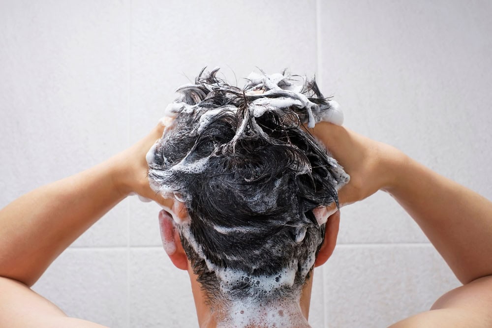 Why Is My Hairline Receding? Answers To Common Questions